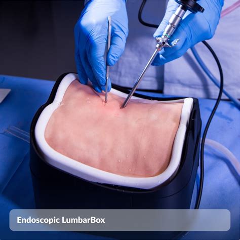 Endoscopic Lumbarbox Upsurgeon Store