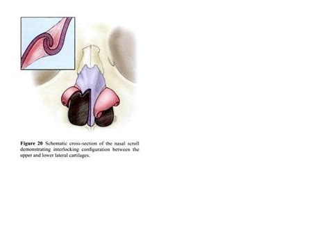 Nose Revision Surgery And Surgeons The Anatomy And Definition Of Nasal