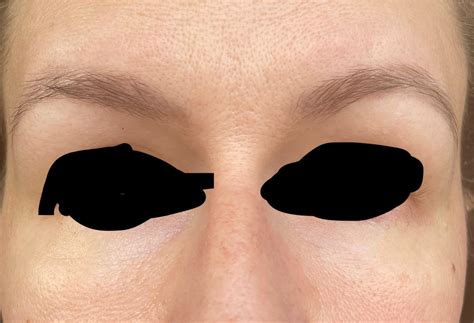 Microblading Cover Up R Microblading
