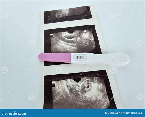 Medical Ultrasound Images Alongside A Pregnancy Test Illustrating