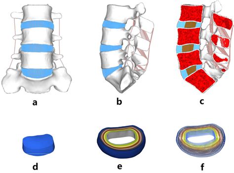 Fe Model Of The Intact Lumbosacral Spine A The Front View Of The