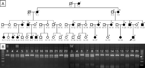 Figure 3 From A Novel Mutation In The Dspp Gene Associated With
