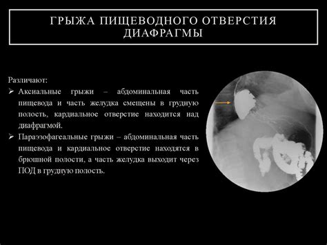 Лучевая диагностика заболеваний пищевода желудка и кишечника Online