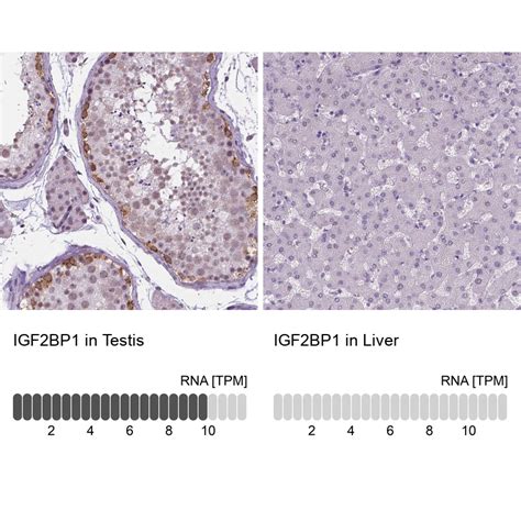 Rabbit Polyclonal Anti Igf2bp1 Antibody Buy For Research Highly