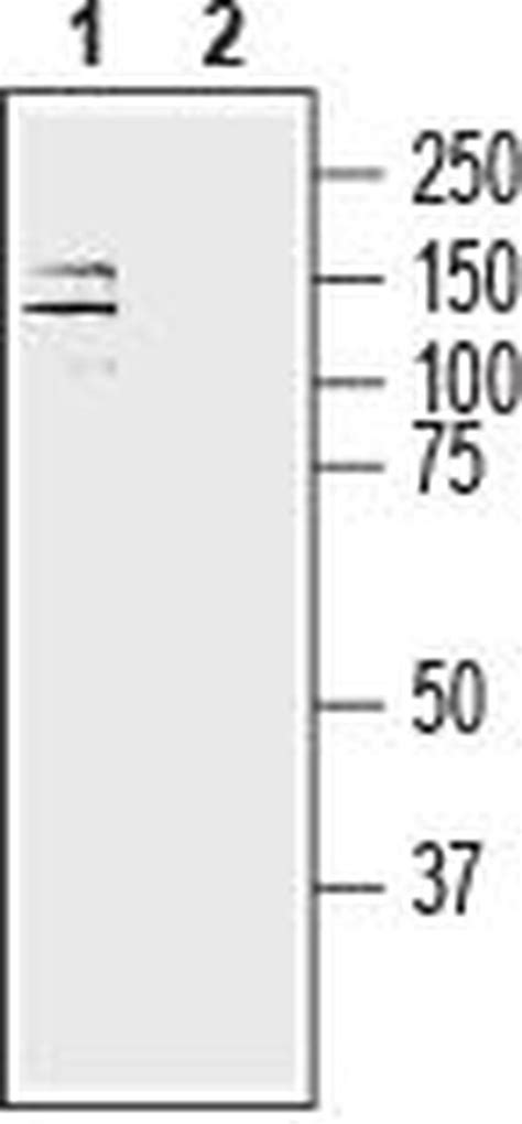 Alpha 3 Na K Atpase Polyclonal Antibody Anp 003 200ul