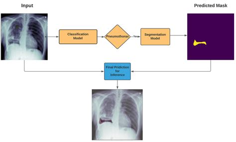 Semantic Segmentation For Pneumothorax Detection And Segmentation By