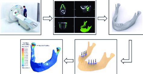 Conversion Of Ct Scan Into A Finite Element Model Download Scientific Diagram