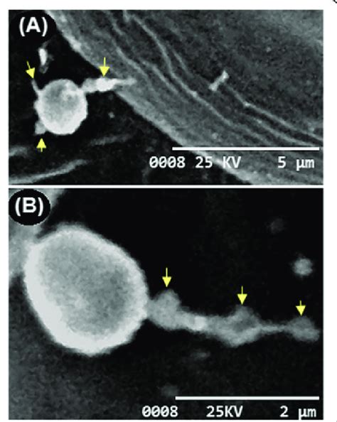 Scanning Electron Microscopy SEM Micrographs Showing The Pattern Of Download Scientific