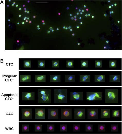 Molecular Profiling Of Single Circulating Tumor Cells From Lung Cancer