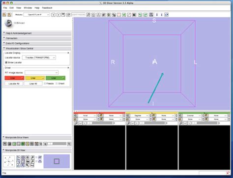 Modules Openigtlinkif Slicer Wiki