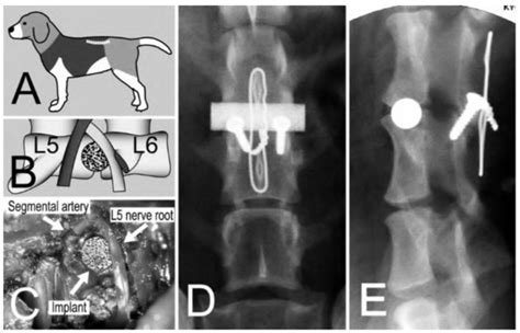 25 A Location Of Surgical Incision B Schematic Illustration Of