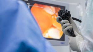 ERCP Procedure Singapore Alpha Digestive Liver Centre