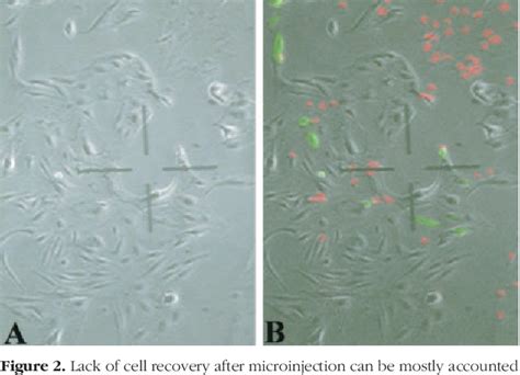 Figure 2 From Nuclear Envelope Irregularity Is Induced By Retptc