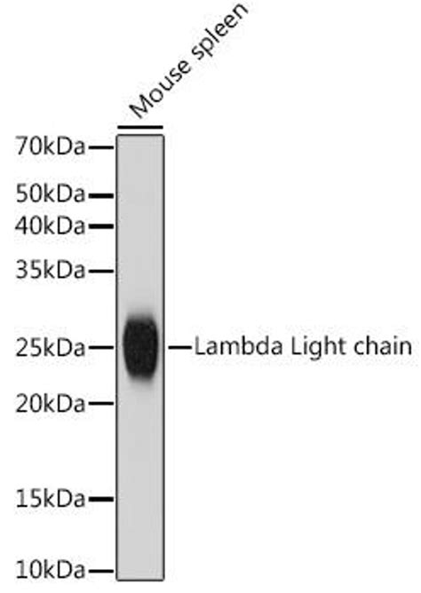 Lambda Light Chain Antibody Humanmouserat Assay Genie