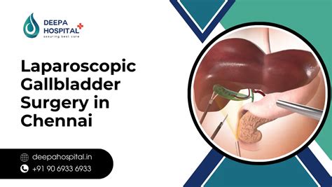 Laparoscopic Gallbladder Surgery In Chennai No1 Best Care