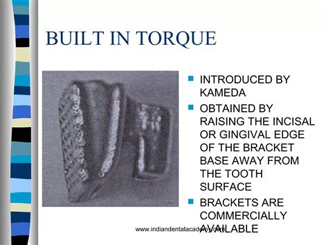 Refined Begg Technique Ppt