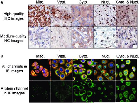 Examples Of Ihc And If Images A Ihc Images With High And Medium