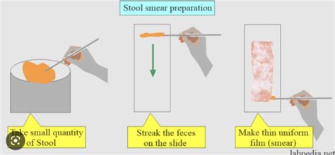 Faecal Analysis And Parasitology Flashcards Quizlet