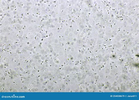 Sperm Cells Or Spermatozoa In Semen Stock Image Image Of