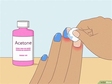 How To Treat An Allergic Reaction To Gel Nail Polish