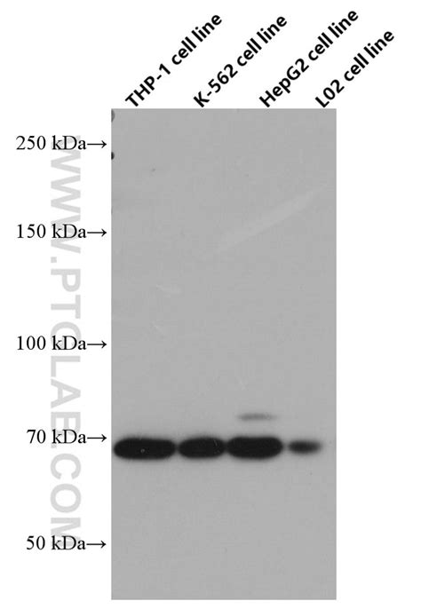 Tgfbr2 Antibody 66636 1 Ig Proteintech