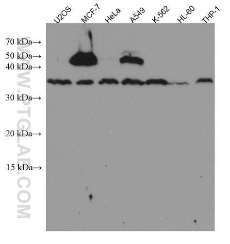 Cd63 Antibody 67605 1 Ig Proteintech 武汉三鹰生物技术有限公司