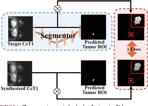 Figure From Tumor Attentive Segmentation Guided Gan For Synthesizing