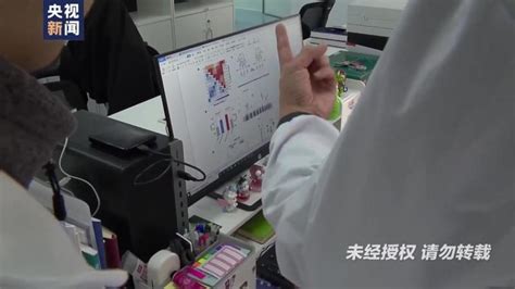【首次揭示！研究发现指纹与身体发育基因关联】近日，我国科学家牵头的一项国际研究首次揭示，人类指纹和肢体发育有高度的基因关联。研究发现，手指斗纹