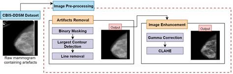 Biology Free Full Text An Effective Ensemble Machine Learning Approach To Classify Breast