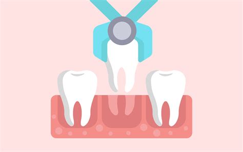 Do I Need An Emergency Tooth Extraction Valley Alder Blog