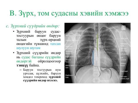 зүрх том судасны дүрс оношлогоо