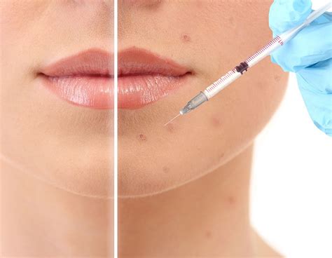 Spot Injection Skin Science Clinic