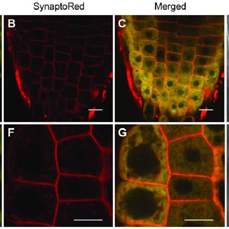 Histochemical Analysis Of Lignin In Basal Stem Cross Sections Wt