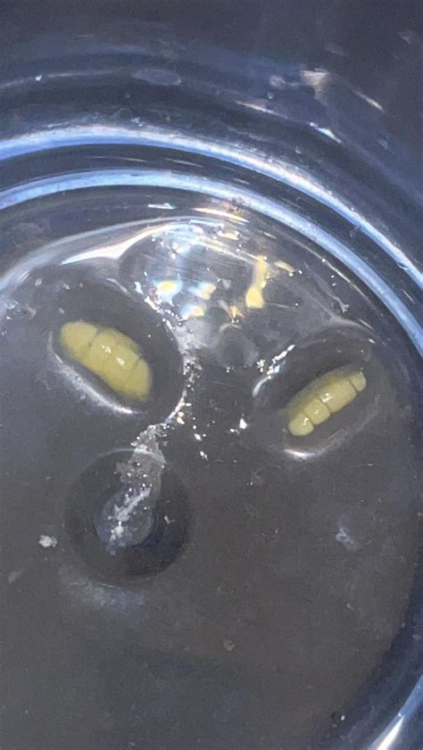 Tapeworm Segments Or White Rice Rparasites