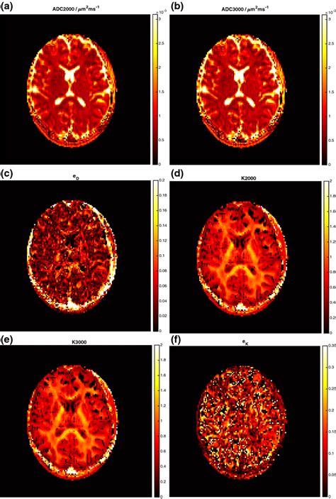 Plot Of ADC Maps Derived Using Maximum B Values Of 2000 A And 3000 Download Scientific