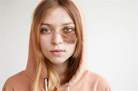Beauty Marks Vs Birthmarks Embracing Your Uniqueness Itechment