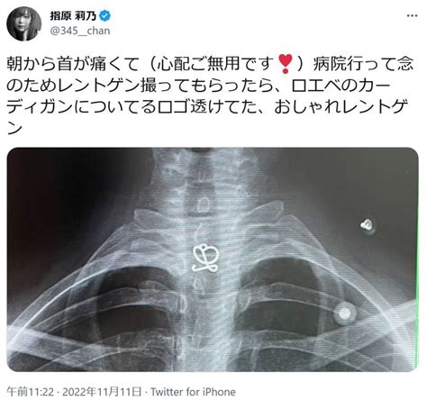 指原莉乃さん「レントゲン撮ってもらったら、ロエベのカーディガンについてるロゴ透けてた」おしゃれレントゲン写真をツイートし反響 ｜ ガジェット