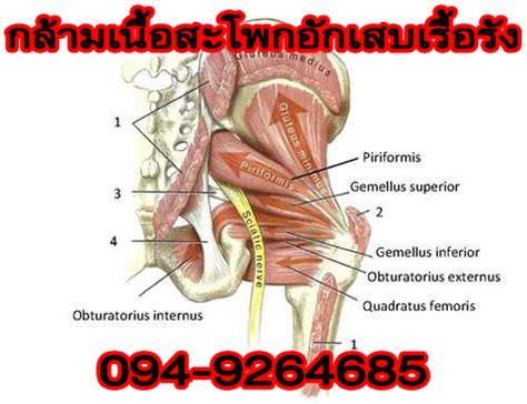 ปวดสะโพก ร้าวลงขา Piriformis Syndrome คือโรคกล้ามเนื้อสะโพก