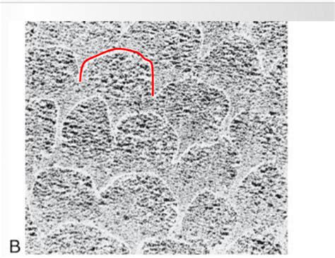 DAM Enamel Dentin Pulp Complex IMAGES Flashcards Quizlet