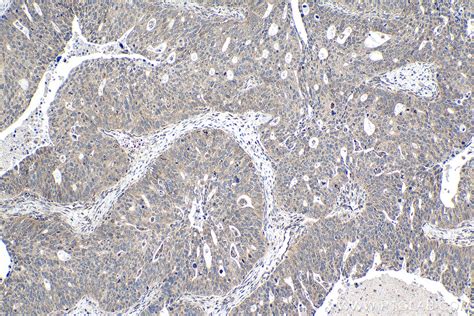 Ihceasy Msi2 Ready To Use Ihc Kit Khc1014 Proteintech