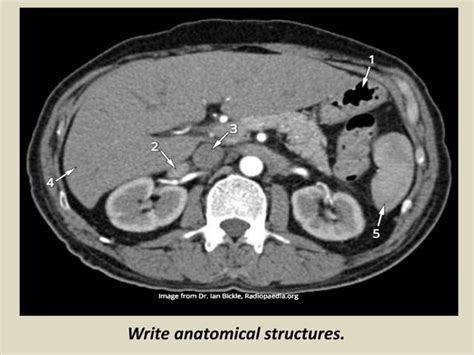 Abdomen And Pelvic Quiz Ppt