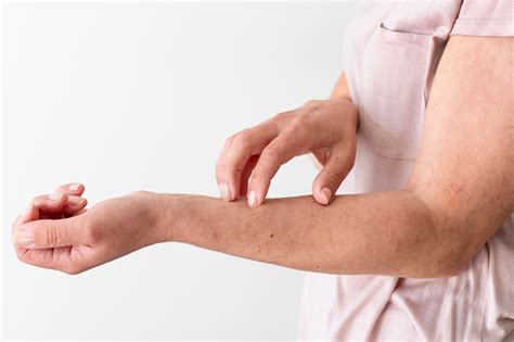 Systemic Vasculitis Heal Medical Rheumatology