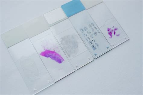 Computational Methods Revolutionizing Prostate Tissue Analysis