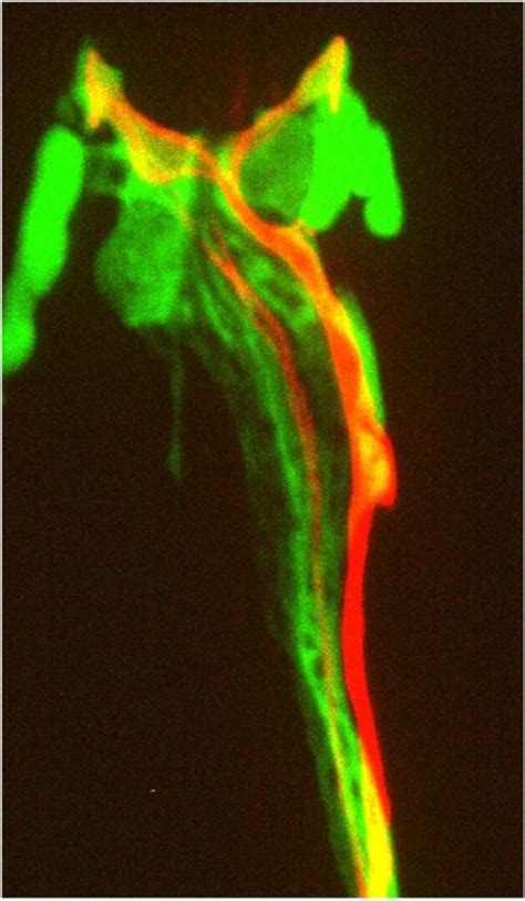 Figure 7 [spinning Disc Confocal Microscope 2 Dimensional