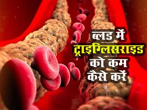 Triglycerides In Blood Triglycerides Diet In Hindi Tryglycerides कम