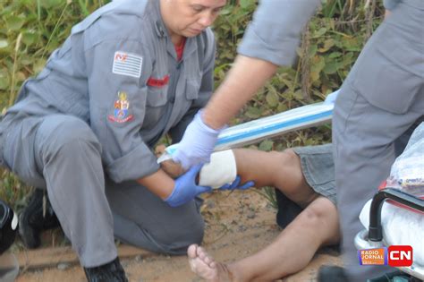 Mulher é Atropelada Por Moto E Sofre Fratura Exposta Na Perna Comando