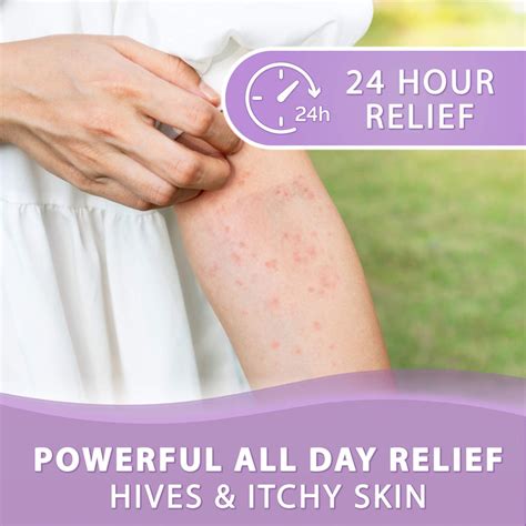 Curist Hives Relief Antihistamine Fexofenadine 180mg For Hives 60 Ct