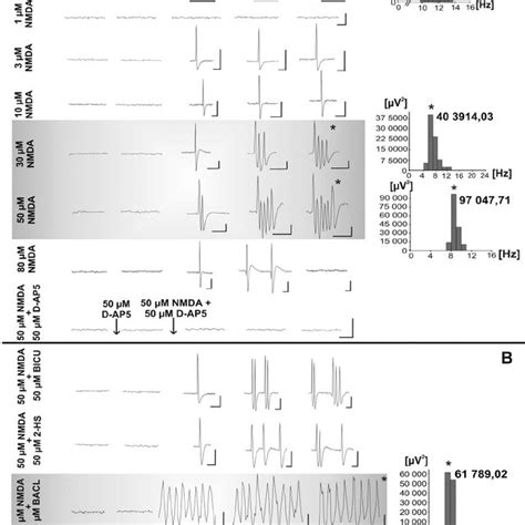 Analogue Examples Of Eeg Activity And Fft Histograms Related With