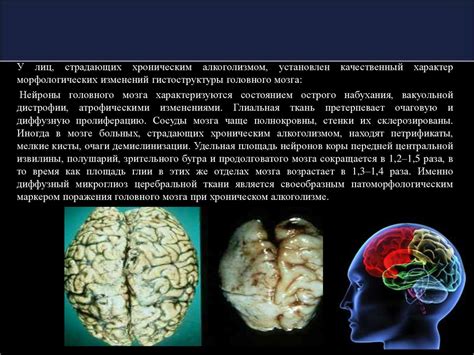 Неврологические нарушения при алкоголизме презентация онлайн