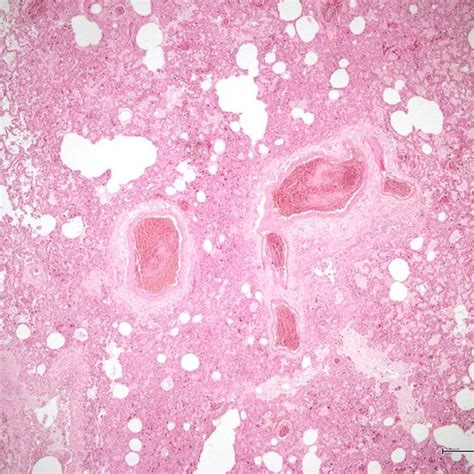 Pdf Chromobacterium Violaceum Infection In Two Black Handed Gibbons